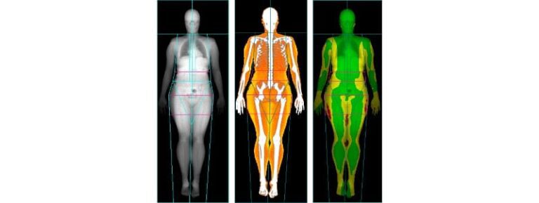 THE GOLD STANDARD IN TOTAL BODY COMPOSITION ASSESSMENT